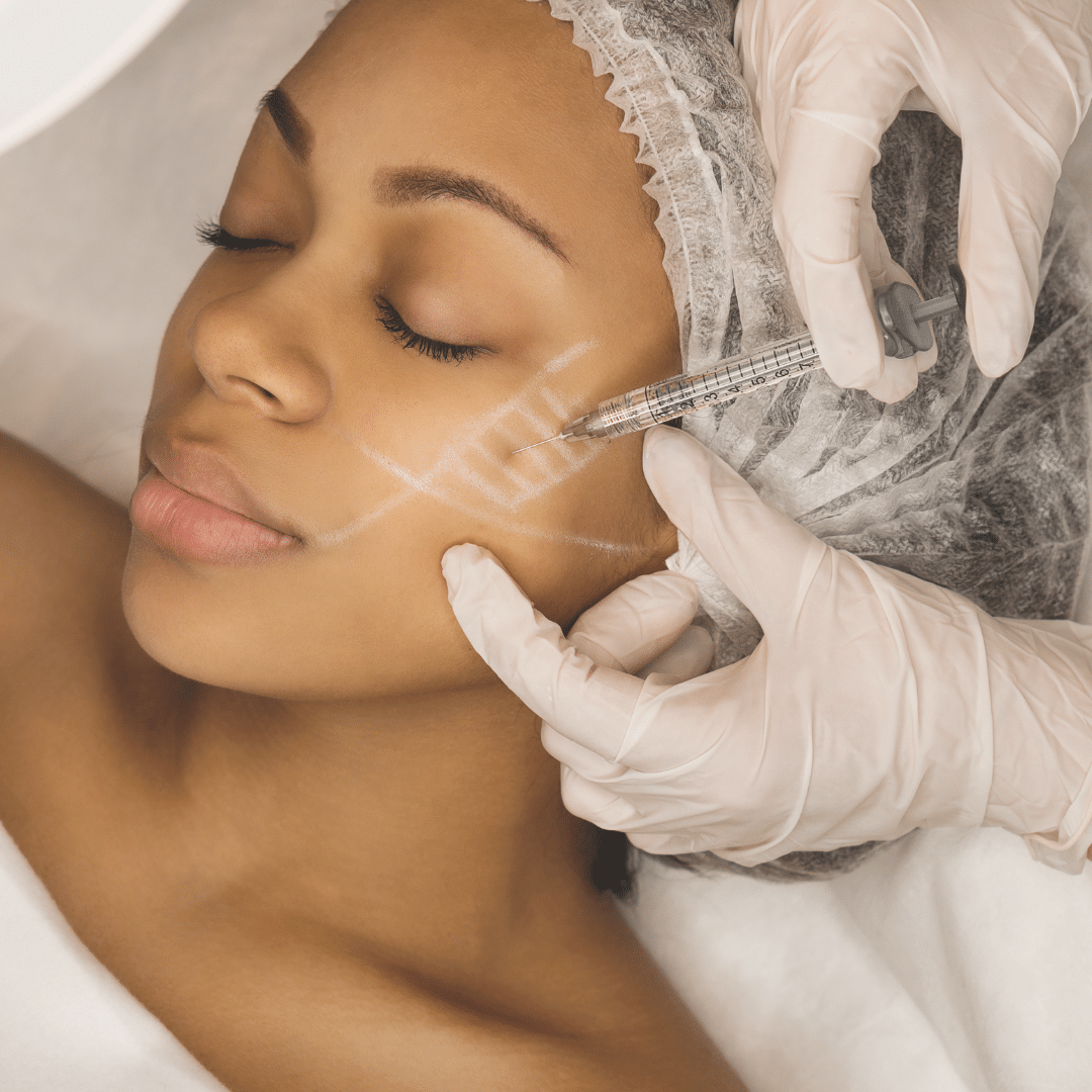 Dermal Fillers: 10 Essential Things You Must Know Before Treatment
